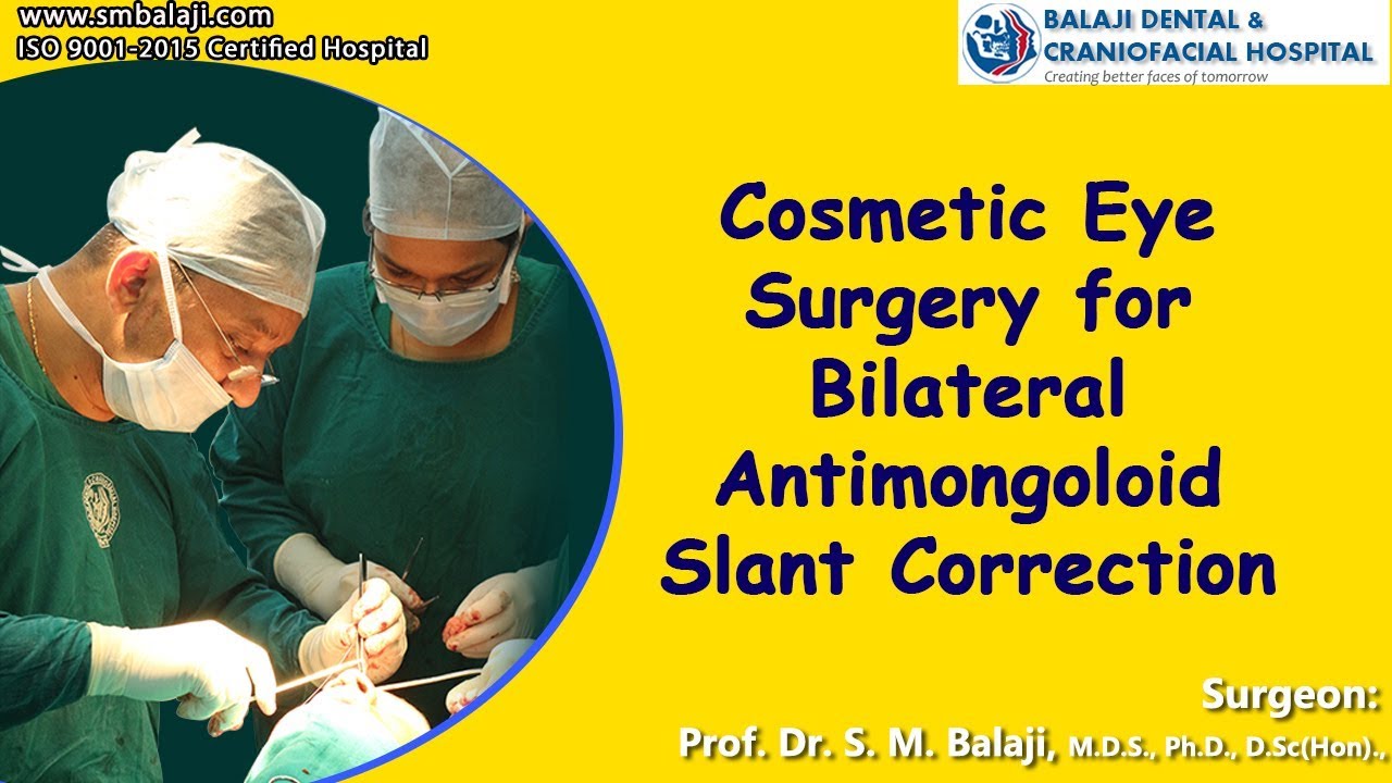 Cosmetic Eye Surgery for Bilateral Antimongoloid Slant Correction ...